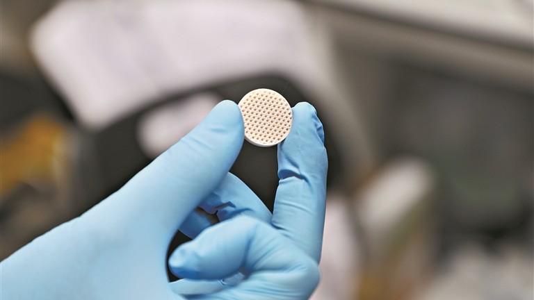 Lotus roots can help restructure bones, heal wounds | GDToday